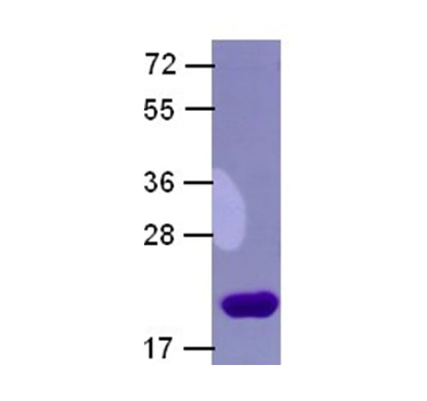Arf1(Δ17) Protein - NewEast Biosciences - GTPase, Oncogene and ...
