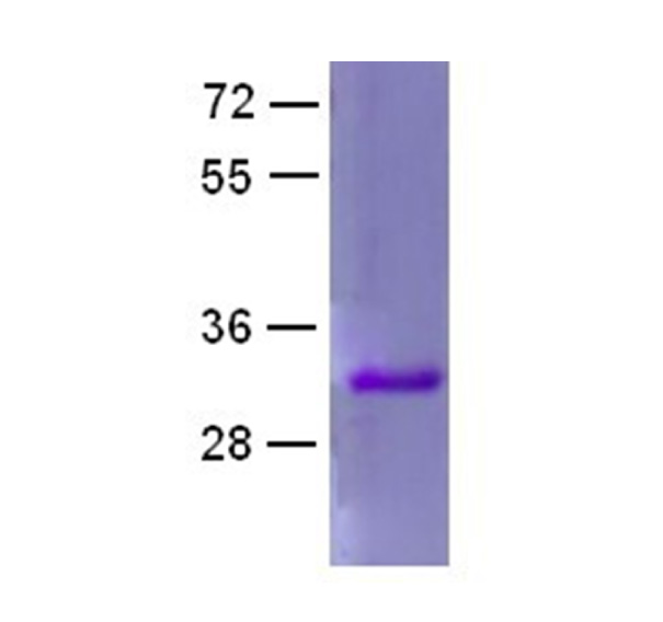 Rab3A(Q81L) Protein - NewEast Biosciences - GTPase and Oncogene