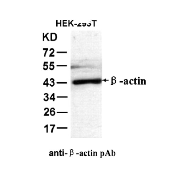 β-Actin pAb - NewEast Biosciences - GTPase and Oncogene