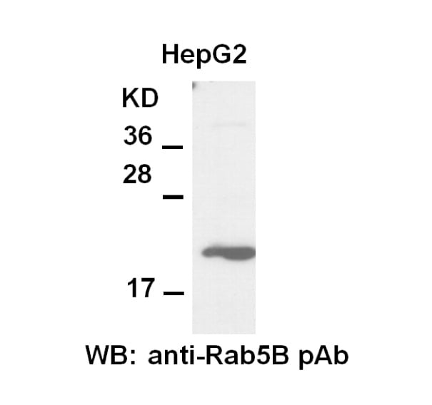Rab5B pAb - NewEast Biosciences - GTPase and Oncogene