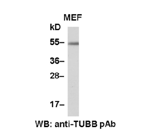 β-Tubulin pAb - NewEast Biosciences - GTPase, Oncogene and Bioactive ...