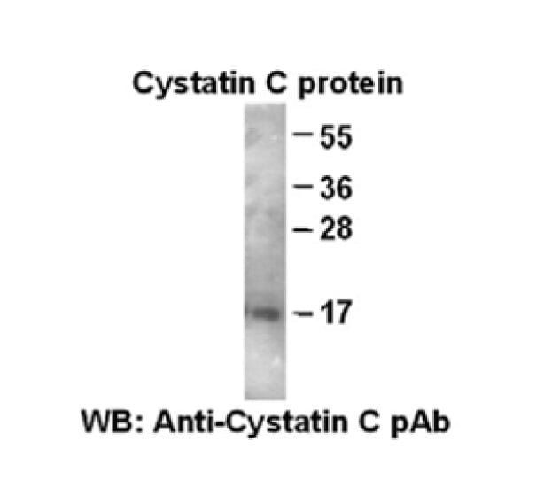 Cystatin C pAb - NewEast Biosciences - GTPase and Oncogene