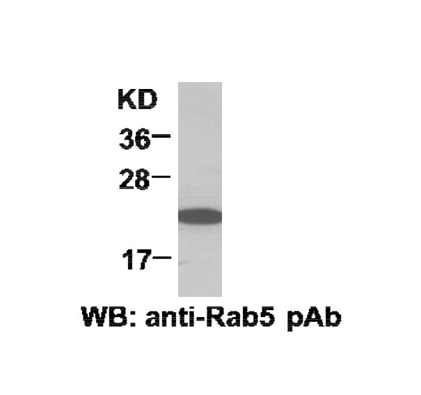Rab5 pAb - NewEast Biosciences - GTPase, Oncogene and Bioactive Protein