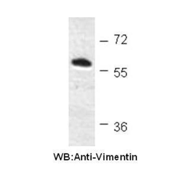 Vimentin mAb - NewEast Biosciences - GTPase and Oncogene