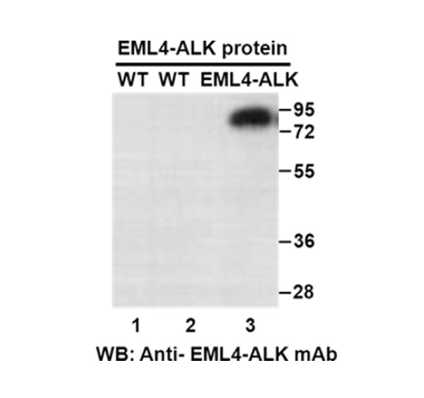 EML4 ALK - NewEast Biosciences - GTPase, Oncogene and Bioactive Protein