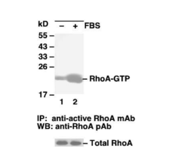 RhoA Pull-Down Activation Assay Kit - NewEast Biosciences - GTPase ...