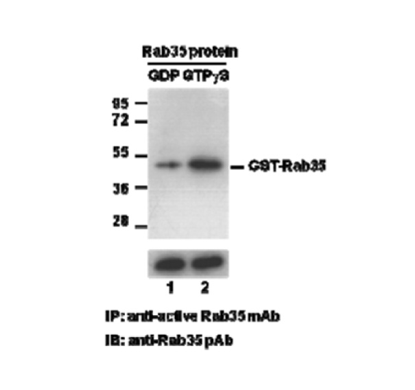 Rab35 Pull-Down Activation Assay Kit - NewEast Biosciences - GTPase ...